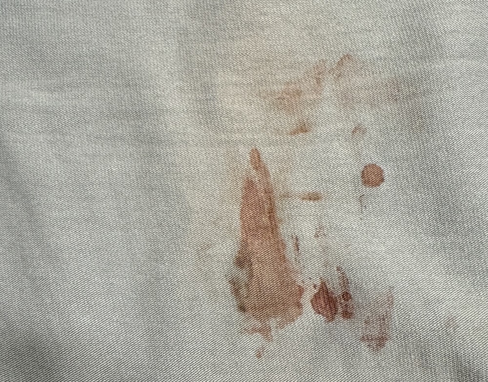 How to Get Blood Out of Fabric - Our Daily Craft