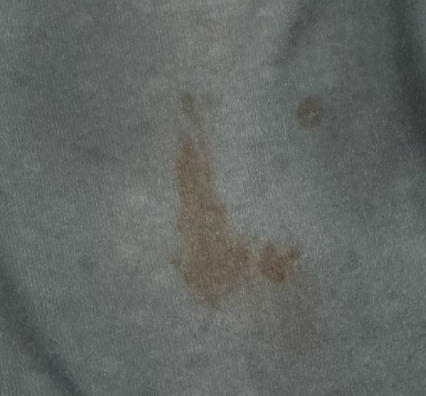 How to Get Blood Out of Fabric - Our Daily Craft